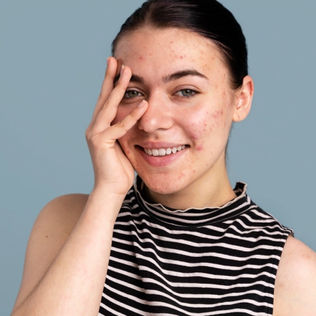 Cómo aplicar tratamiento capilar paso a paso: Consejos - EVO Beauty Clinics